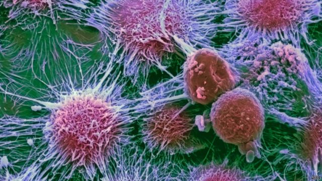 Tecnecio: el elemento que puede hacer brillar los huesos - BBC News Mundo