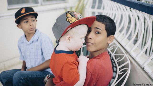 En fotos: La compleja vida de los albinos bajo el apabullante sol de ...