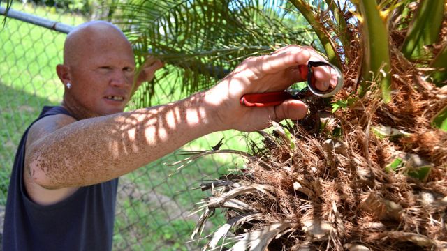 La conmovedora historia de la familia de albinos que vive en el ...