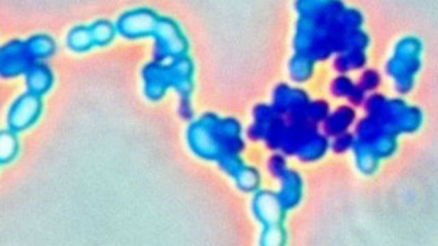 El misterioso retorno de la escarlatina, la enfermedad antigua que pone ...