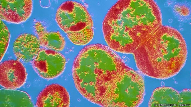 Maambukizi ya kaswende na kisonono juu England - BBC News Swahili