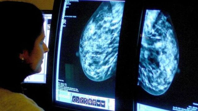 Ribuan penderita kanker dapat bertahan hidup lebih lama - BBC News ...