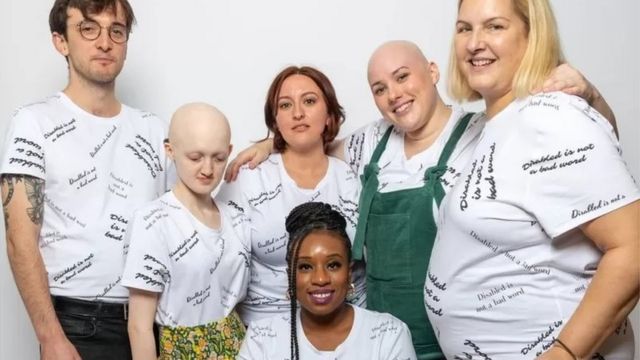 Alopécie : Comment une jeune femme a-t-elle fait face à sa calvitie ...