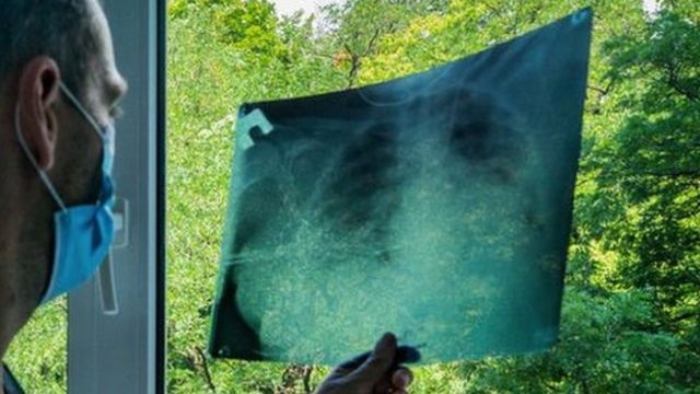 Nauka i iks zraci: Šta je rendgen i zašto medicina ne može bez njega ...