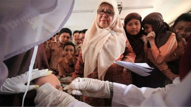 Kisah seorang ibu di Aceh yang anaknya alami rubella: 'Saya pikir panas ...