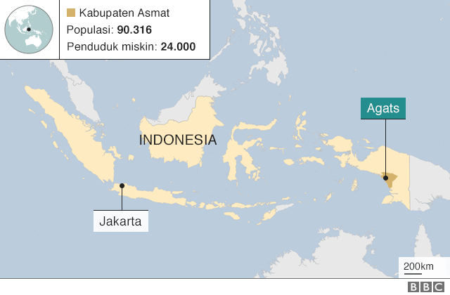 Lima hal yang perlu Anda ketahui tentang wabah campak dan gizi buruk di ...