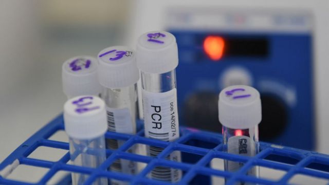 Omicron: Yeni Covid varyantı nasıl tespit ediliyor? - BBC News Türkçe