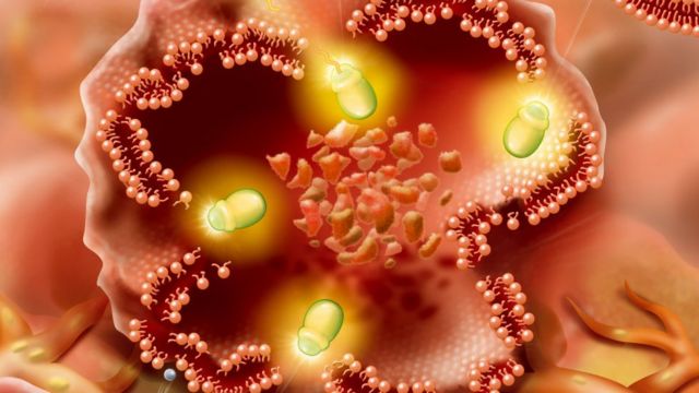 Ditemukan obat baru 'yang efektif sembuhkan' pasien kanker stadium ...