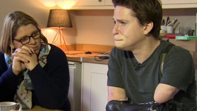 Após perder todos os membros por infecção, britânico vence dificuldades ...