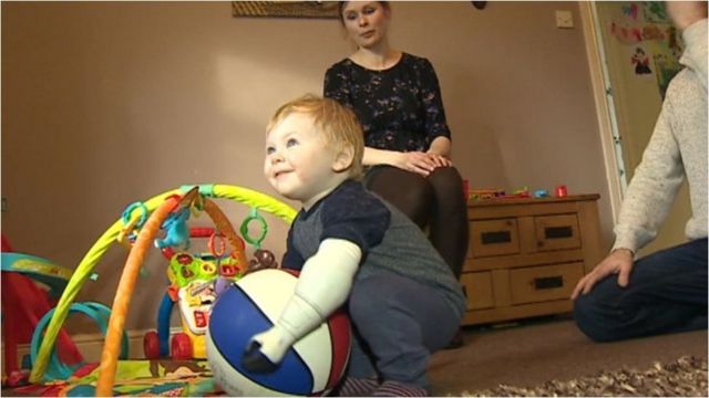 El padre que no paró hasta que logró diseñar e imprimir un brazo para ...