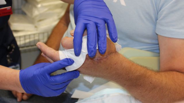 Uingereza: Wapasuaji waunganisha mkono uliokatwa kwa msumeno - BBC News ...