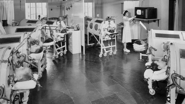 Medicina i istorija: Lečenje dečije paralize - od „čeličnih pluća" do vakcine - BBC News na srpskom