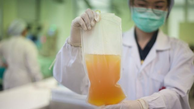 Tratamiento de la covid-19: qué son los anticuerpos monoclonales y por qué podrían ser una ...