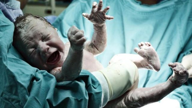 Transtorno pós-parto: por que ocorre e como combater - BBC News Brasil