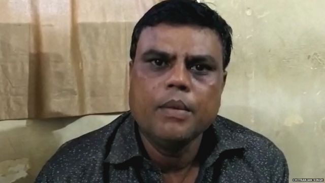 छठी बेटी के शक में गर्भवती पत्नी का हँसिये से काट दिया पेट - BBC News हिंदी