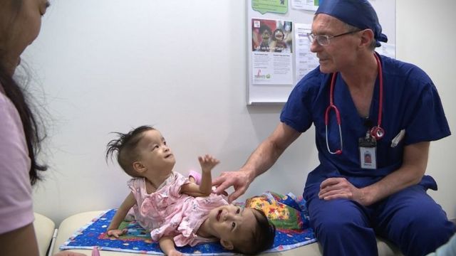 La exitosa operación para separar a gemelas siamesas de Bután en ...
