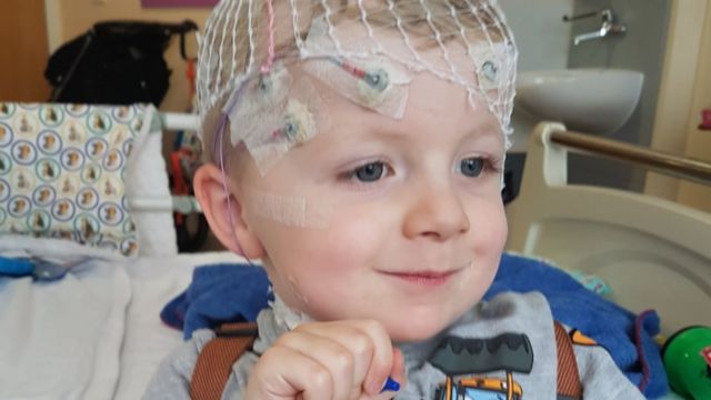 El niño con el misterioso síndrome sin nombre que desconcierta a los ...