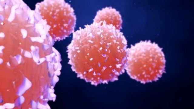 Je wajua kwamba mabadiliko ya mfumo wa maisha yanaweza kusababisha ...