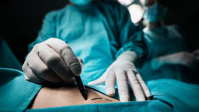 ¿Qué ocurre con los cuerpos que se donan a la ciencia? - BBC News Mundo