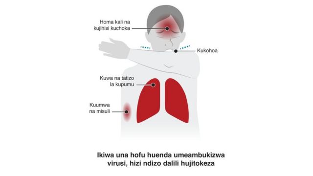 Coronavirus: Mtu wa kwanza ajitolea kufanyiwa chanjo ya virusi vya ...