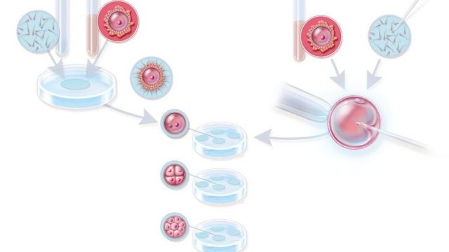 Fécondation in vitro : Miriam Menkin, la scientifique qui a changé l ...