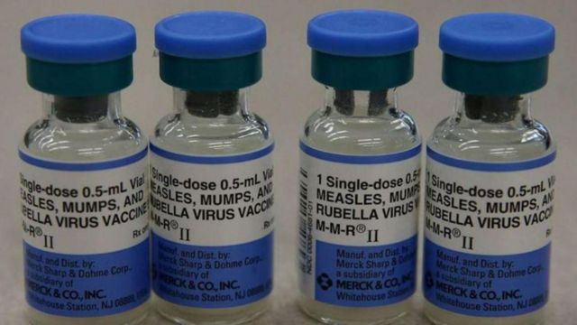 పిల్లల్లో గవదబిళ్లలు ఎందుకు వస్తాయి? లక్షణాలు ఏమిటి? చికిత్స ఎలా ...