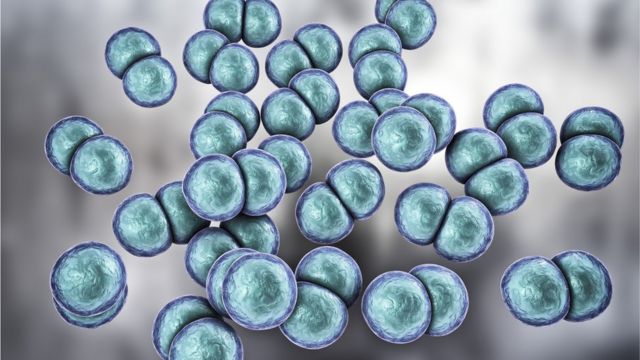 Magonjwa ya ngono yaongezeka Uingereza - BBC News Swahili