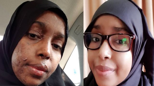 Saynab: Dilal dhowr ah ayaan ka badbaaday, welina naftaan u hurayaa ...