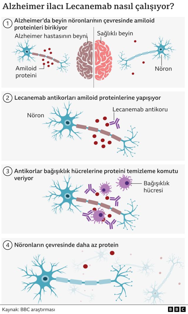 Alzheimer'ın beyindeki tahribatını yavaşlatan ilk ilaç Lecanemab, bilim ...