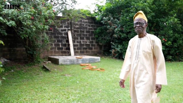 Ìrírí àgbà: Oladele Awobuluyi ní Nàíjíríà yóò jìyà báwọn dókítà ṣe ń yọ ...