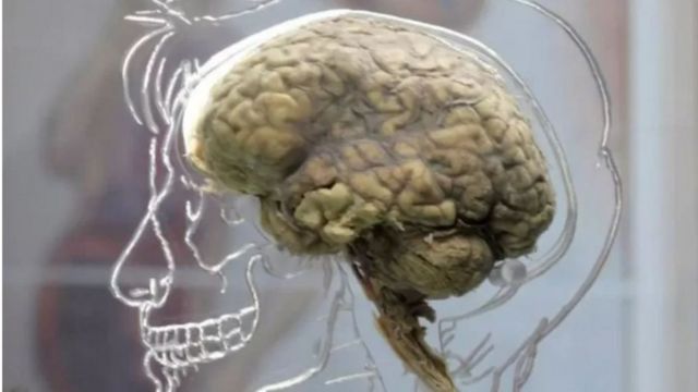 पोटातही असतो आणखी एक मेंदू? म्हणूनच भीती वाटली की पोटात खड्डा पडतो ...