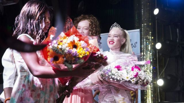 Zimbabwe don crown dia first Miss Albino - BBC News Pidgin