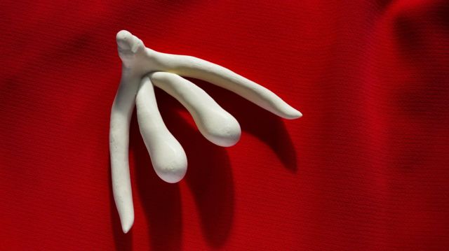 Klitoromegali: Kesaksian perempuan Brasil yang menjalani operasi ...