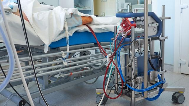ECMO คืออะไร ทำงานอย่างไร ในผู้ป่วยหัวใจผิดปกติ - BBC News ไทย