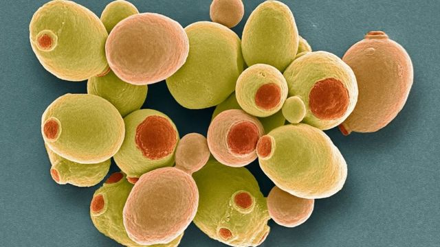 Syndrome d'auto-brasserie : que savons-nous sur ce mystère ? - BBC News ...