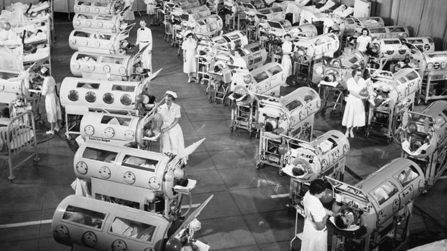 Medicina i istorija: Lečenje dečije paralize - od „čeličnih pluća" do vakcine - BBC News na srpskom