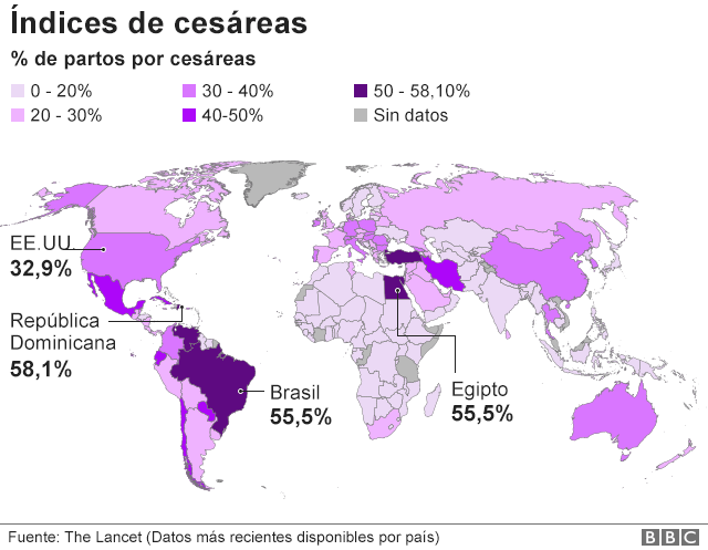 Por qué preocupa el aumento de cesáreas en todo el mundo (y en América ...