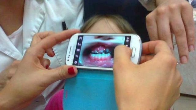 Zdravlje: „To nije samo estetski problem" - život ljudi sa zečjom usnom ...