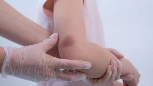 Rusija i Ukrajina: „Za tri meseca videla sam dete jednom" - zašto se Ukrajincima oduzimaju deca ...