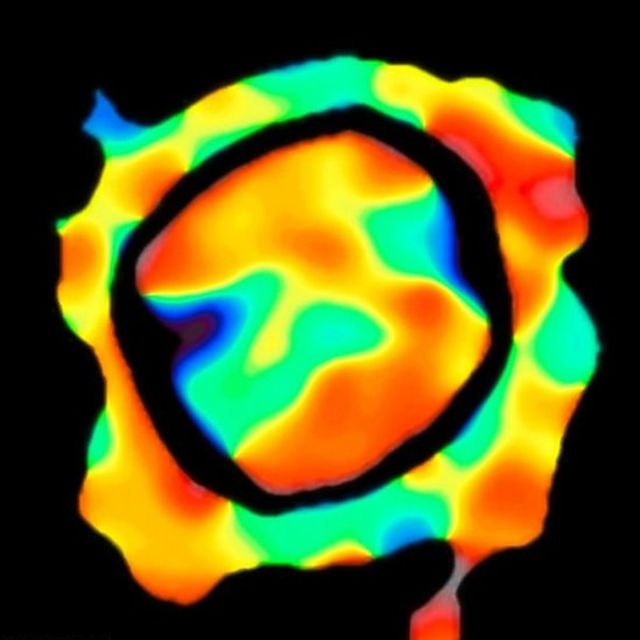 La impresionante imagen de Antares, la estrella agonizante que se está ...