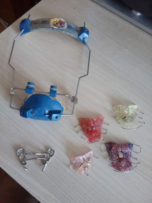 Zdravlje: „To nije samo estetski problem" - život ljudi sa zečjom usnom ...