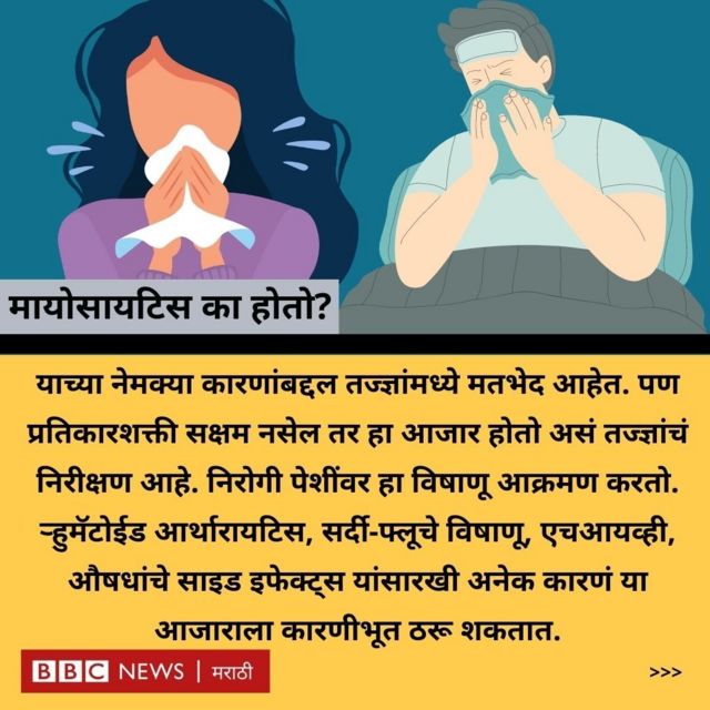 मायोसायटिस: समांथाला झालेला दुर्मिळ आजार काय आहे, त्याची लक्षणं काय ...