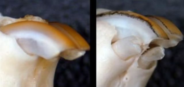 War farxad galinaya dadka ilkaha la’ - BBC News Somali