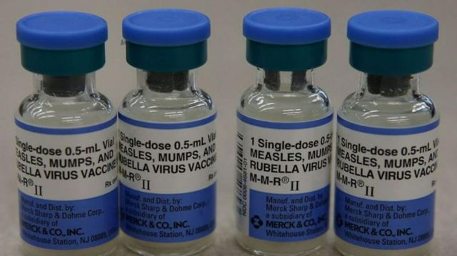 Mumps : गालगुंड किंवा गालफुगी म्हणजे काय? त्याची साथ कशी पसरते? - BBC ...