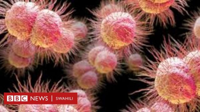 STDs: Aina mbili mpya sugu za magonjwa ya zinaa zagunguliwa Kenya - BBC ...