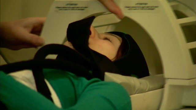 Early use of patch 'could help treat strokes' - BBC News