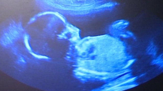 Ultrasound training boosted by 'revolutionary' simulator - BBC News