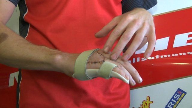 Isle of Man TT 2015: Birchall brothers win Sidecar opener - BBC Sport