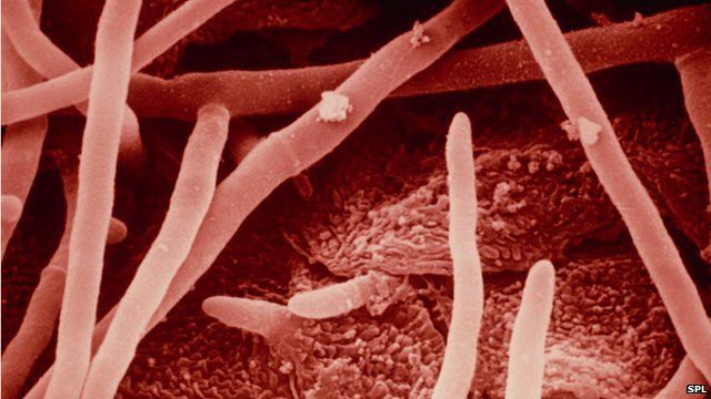 Athletes Foot Under Microscope