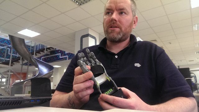 3D printers used for prosthetic limbs in Syria conflict - BBC News